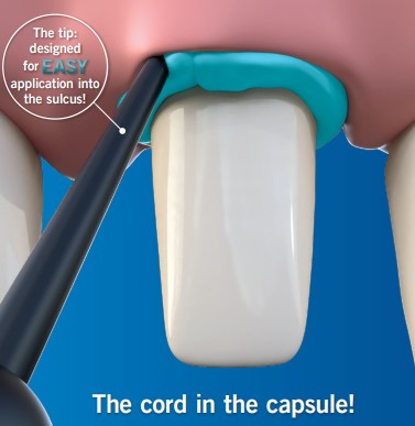 Request a Sample of VOCO Retraction Paste